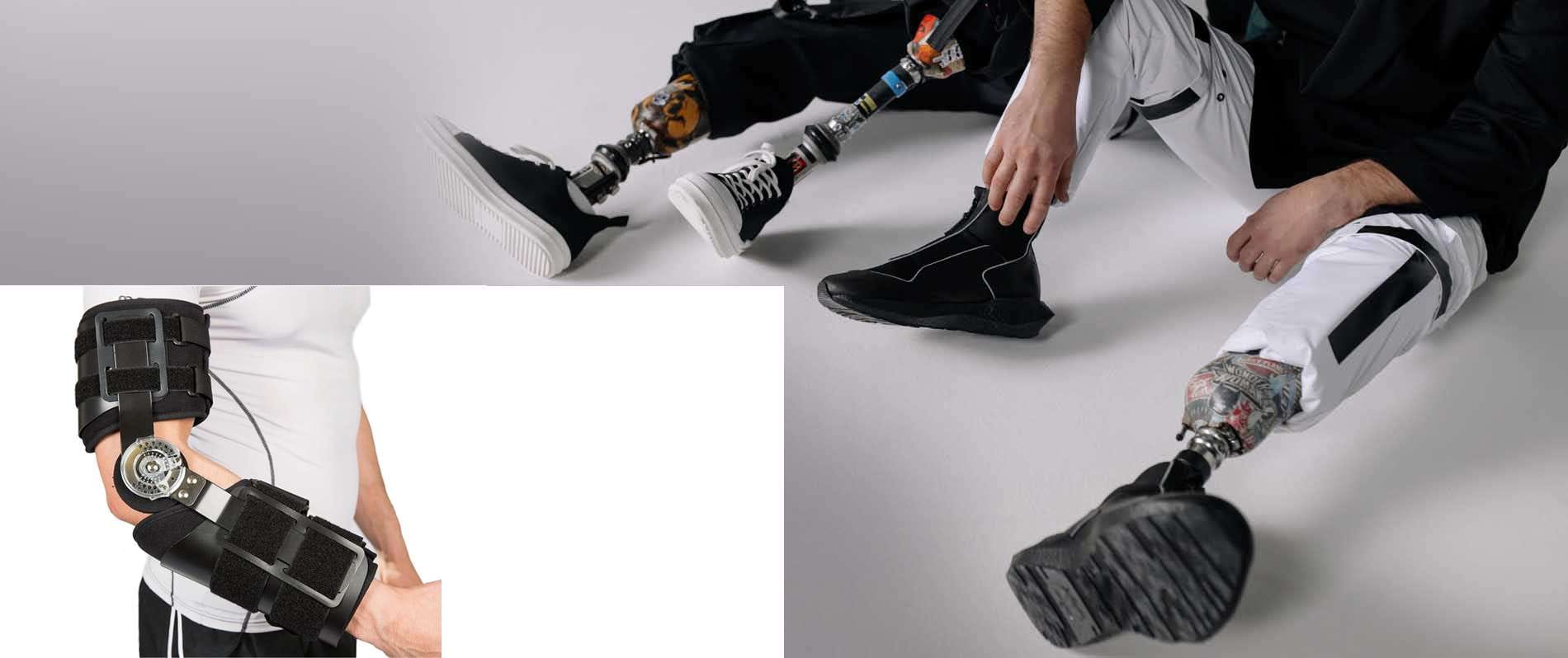 About Prosthetic and Orthotic/Prosthetic and Orthotic can help you?